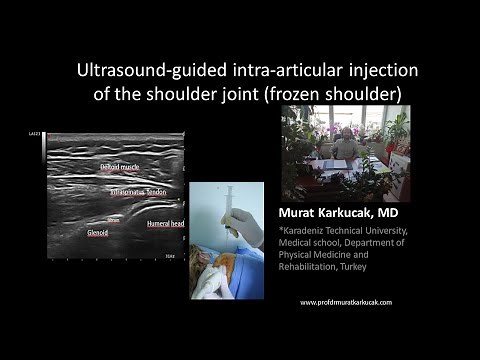 Ultrasound-guided intra-articular injection of the shoulder joint (frozen shoulder)