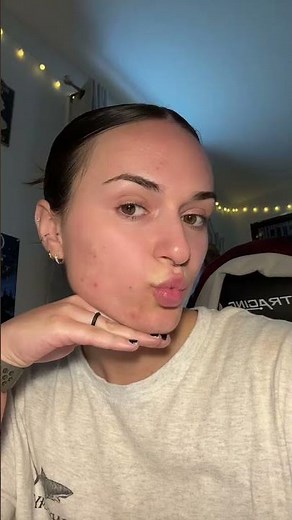 Differing Gel Acne 2 Month Transformation with @annmarieefit