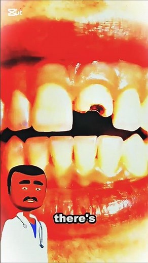 From Rotten Teeth to Perfect Smile | Tooth Decay Treatment Before & After