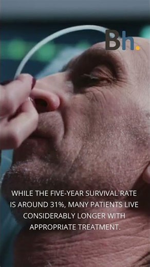 How Long Can You Live With Stage 4 Prostate Cancer?