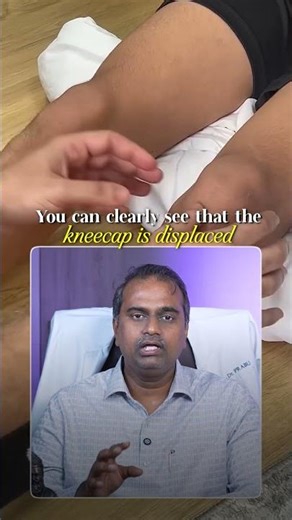 Locked Knee After Sports?இதுதான் காரணம்!-Dr.Ma.Kamaatchi Prabu #orthopedic #sportsinjury