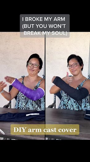 DIY Arm Cast Cover: Protect Your Cast with Little Girl’s Leggings
