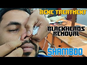 SHAMBOO💈Acne Treatment and Blackheads Removal with Face Cleaning💈MASTER ASMR💈#ASMR