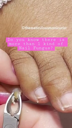 ⭐ ONLINE NAIL EDUCATION CLASSES Nail Technicians 📚 https://pedicuretraining.com https://academy.themeticulousmanicuri... ⭐ Online Training at Home for CAREGIVERS https://pedicuretraining.com/athometr... ⭐ Nail School Partner Program https://www.meticulousmanicurist.com/... ======================== 💻 ONLINE STORE 🛒 Https://meticulousmanicurist.com/shop 🛒 🔹 All videos: https://www.youtube.com/c/TheMeticulo... ======================== 🔎FIND A METICULOUS MANICURIST NEAR YOU https://www.meticul