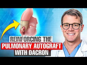 Ross Procedure Insight: Reinforcing the Pulmonary Autograft with Dacron Graft