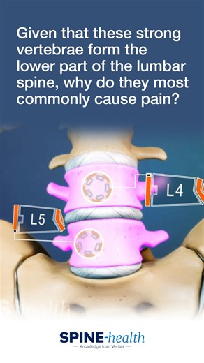 Use these 5 key insights to better understand L4-L5 spinal problems—from causes of back pain and sciatica to treatment options that actually work.  Whether you're dealing with a bulging disc, degenerative disc disease, or nerve compression, this video covers what you need to know now. #L4L5 #BackPainRelief #Sciatica #SpineHealth #LowerBackPain #BulgingDisc | Arthritis-health | Facebook