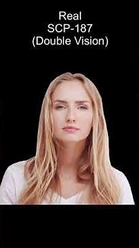 SCP-187 | Double Vision (SCP Library)