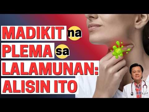 Madikit na Plema sa Lalamunan: Alisin Ito - By Doc Willie Ong (Internist and Cardiologist)
