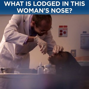 Next time you've got a blocked nose, it might be worth getting it checked out! 🤮 | Discovery Channel UK