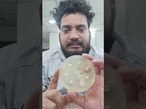 Antibiotics Suspetibilty Testing(AST) Disk diffusion method procedure , principal and Interpretation