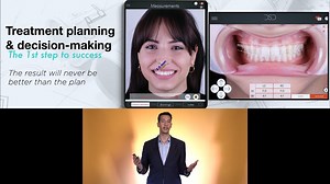 DSD App high-impact smile simulations webinar teaser with Luken de Arbeloa