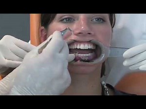 KaVo ARCUSdigma: Articulator Programming