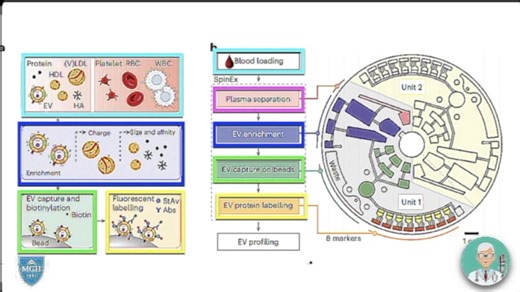 Better Technology For Liquid Cancer Biopsies A new “lab on a spinning disc” can detect and speed the analysis of cancer Markers that will help to revolutionize both diagnosis and management of malignant disease. Bioengineers at Boston’s Mass General Hospital have developed a fully automated device named SpinEx that is capable of isolating and analyzing tiny particles in the blood known as extracellular vesicles, or EVs. These vesicles are released by tumor cells and carry molecular signals that 