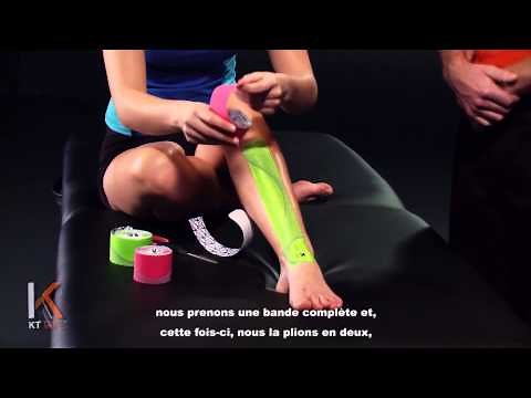 Périostite tibiale - KT TAPE France (Shin Splints)