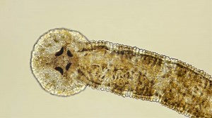 Leech Fish Leech Piscicola Under Microscope Stock Footage Video (100% Royalty-free) 1031948534 | Shutterstock