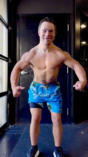 11K views · 387 reactions | Men with Down syndrome are at higher risk...