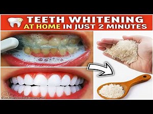 🦷 Teeth Whitening at Home in Just 2 Minutes 🪥 – How to Whiten Teeth at Home? 💯 100% Effective 😁