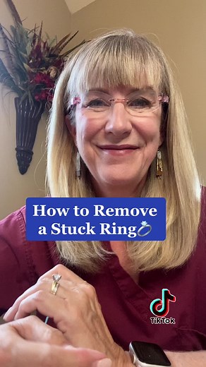 How to Easily Remove a Stuck Ring: Doctor's Tips Revealed!
