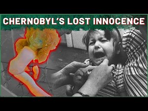 The Children of Chernobyl - the tragic legacy of the disaster ||| PART 1