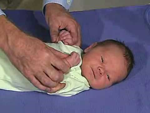 physical exam -Newborn Normal: Tone - Arm Recoil