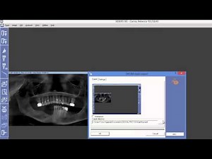 Sirona3D DICOM Export