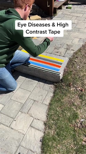 Understanding Eye Diseases Through Vision Simulation