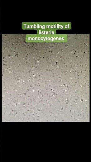 ➡️ Tumbling motility of listeria monocytogenes #microbiology