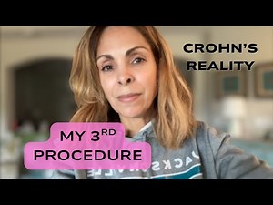 My 3rd Sigmoidoscopy | VLOG | Living With STRICTURES