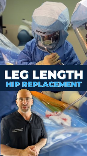 Cory Calendine MD | 🦿 Understanding Leg Length Discrepancy After Hip Replacement - Up to 25% of patients experience leg length differences after total... | Instagram