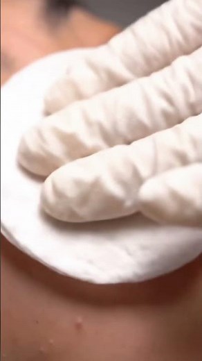 ASMR Nose Deep Clean 💧 Gentle Blackhead & Whitehead Removal | Satisfying Pore Cleaning Sounds