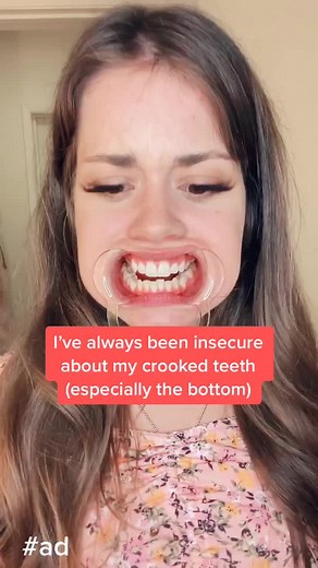 Transform Your Smile at Home with Byte Impression Kit