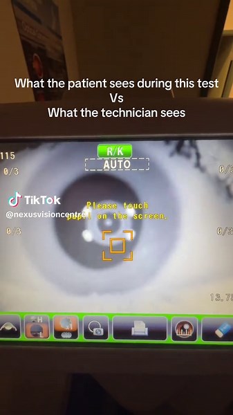 POV: You’re looking at the barn during your eye exam vs what your technician actually sees… Spoiler: You’re doing the eye cha-cha. Moral of the story — stay still so we can get that perfect scan! #vision #optometry #visioncare #optometrist #optometrist #opticalassistant
