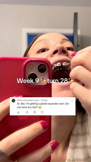 3 Must-Know Tips Before Getting a Palatal Expander