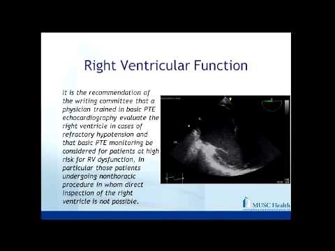 Basic Perioperative Transesophageal Echocardiography Examination