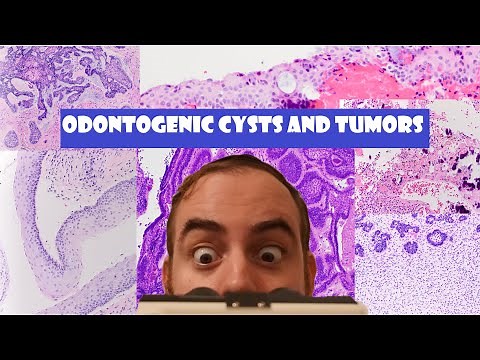 The ULTIMATE Odontogenic Cyst and Tumor Review Video