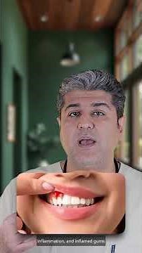 Why Are My Gums Bleeding? Important Causes You Should Know!