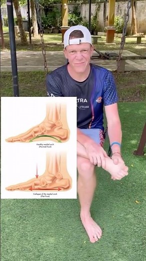 Running with flat feet #runningtips #flatfeet #runninglife #trailrunning