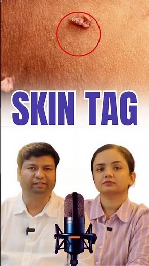 Skin Tag Removal at Home: Safe or Risky? | Dermatologist Explains | The Skin smiths Clinic
