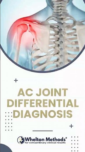 AC Joint Pain Demystified: The Real Diagnosis