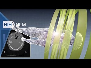 Computerized Tomography CT