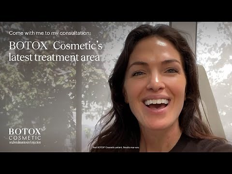 Before and After: BOTOX® Cosmetic for vertical bands connecting the neck and jaw