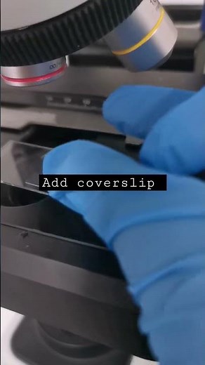 Urine Sediment Epithelial cells and Mucus Threads under the microscope #laboratory #medtechstudent