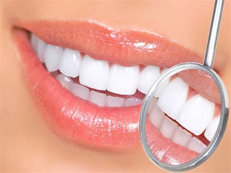 Bradesco Dental Plano Odontológico