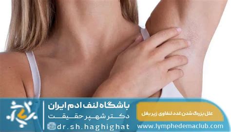 تورم غدد لنفاوی زیر بغل تشخیص و درمان لنفادنوپاتی زیر بغل