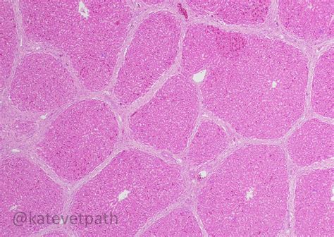 Liver Histology Diagram Quizlet