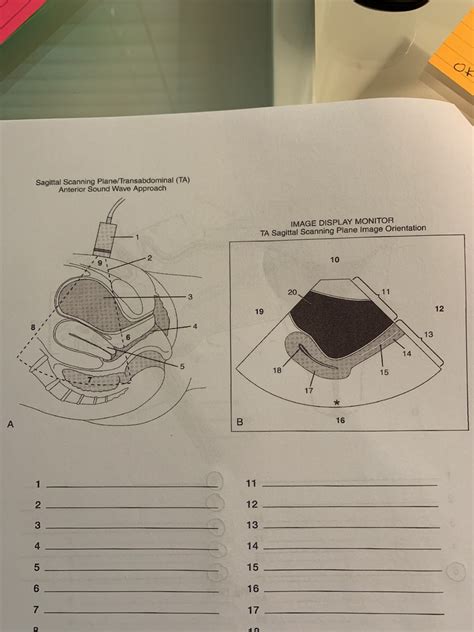 Normal Pelvic Anatomy Diagram 4 Diagram Quizlet