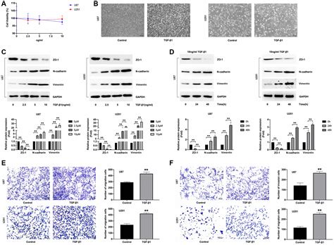 Inhibition of TGF β1 induced epithelial mesenchymal transition in