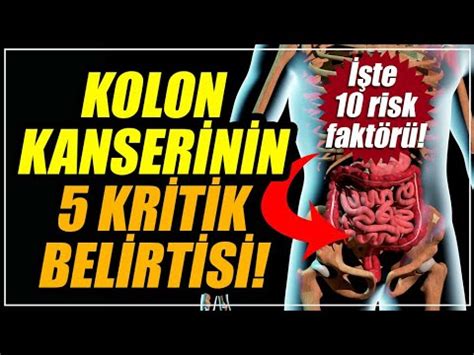 Kolon kanserinin 5 kritik belirtisi Kolon Bağırsak kanseri