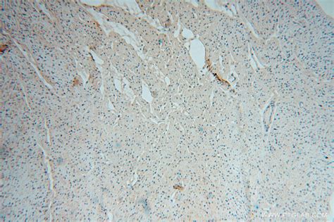 CD36 antibody 11378 1 AP Proteintech 武汉三鹰生物技术有限公司