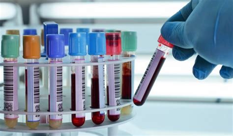 Toma De Muestras Tecnica De Enfermeria